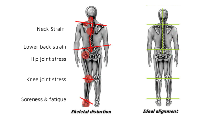 Is your head on straight? Why body alignment is important - pilates